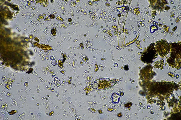 soil microorganisms close up under the microscope. in soil from a farm ...