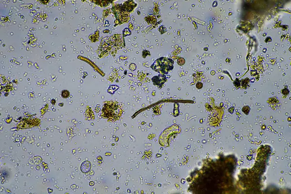 soil microorganisms close up under the microscope. in soil from a farm ...