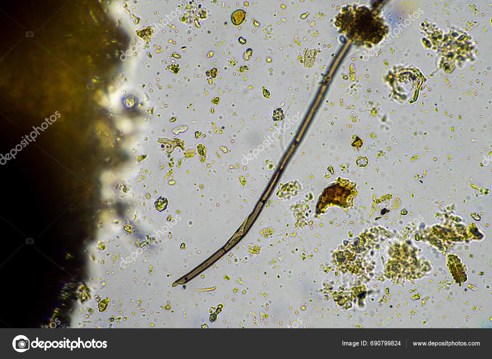 Fungus Fungal Hyphae Soil Sample Farm Microorganisms Soil Biology Stock ...