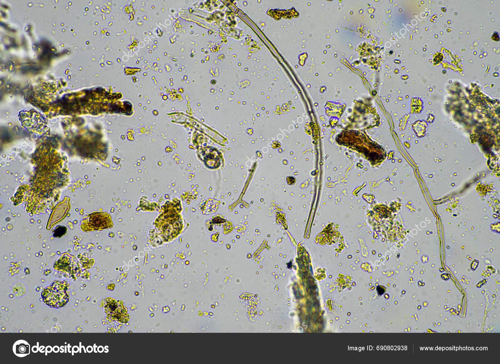 Fungus Fungal Hyphae Soil Sample Farm Microorganisms Soil Biology Stock ...