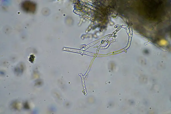 Amoeba microscope Stock Photos, Royalty Free Amoeba microscope Images ...