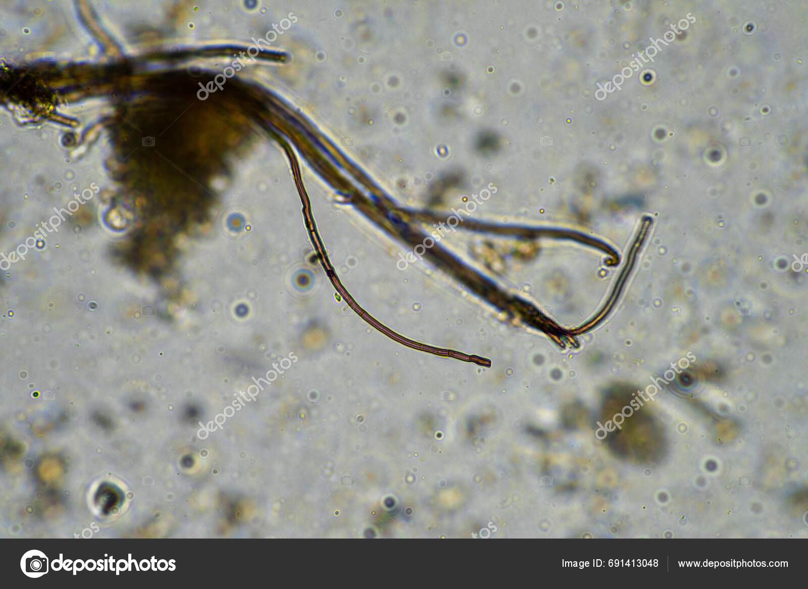 Microorganisms Soil Biology Nematodes Fungi Microscope Soil Compost ...