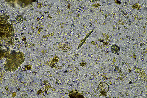 Microorganisms and biology in Compost and soil sample under the ...