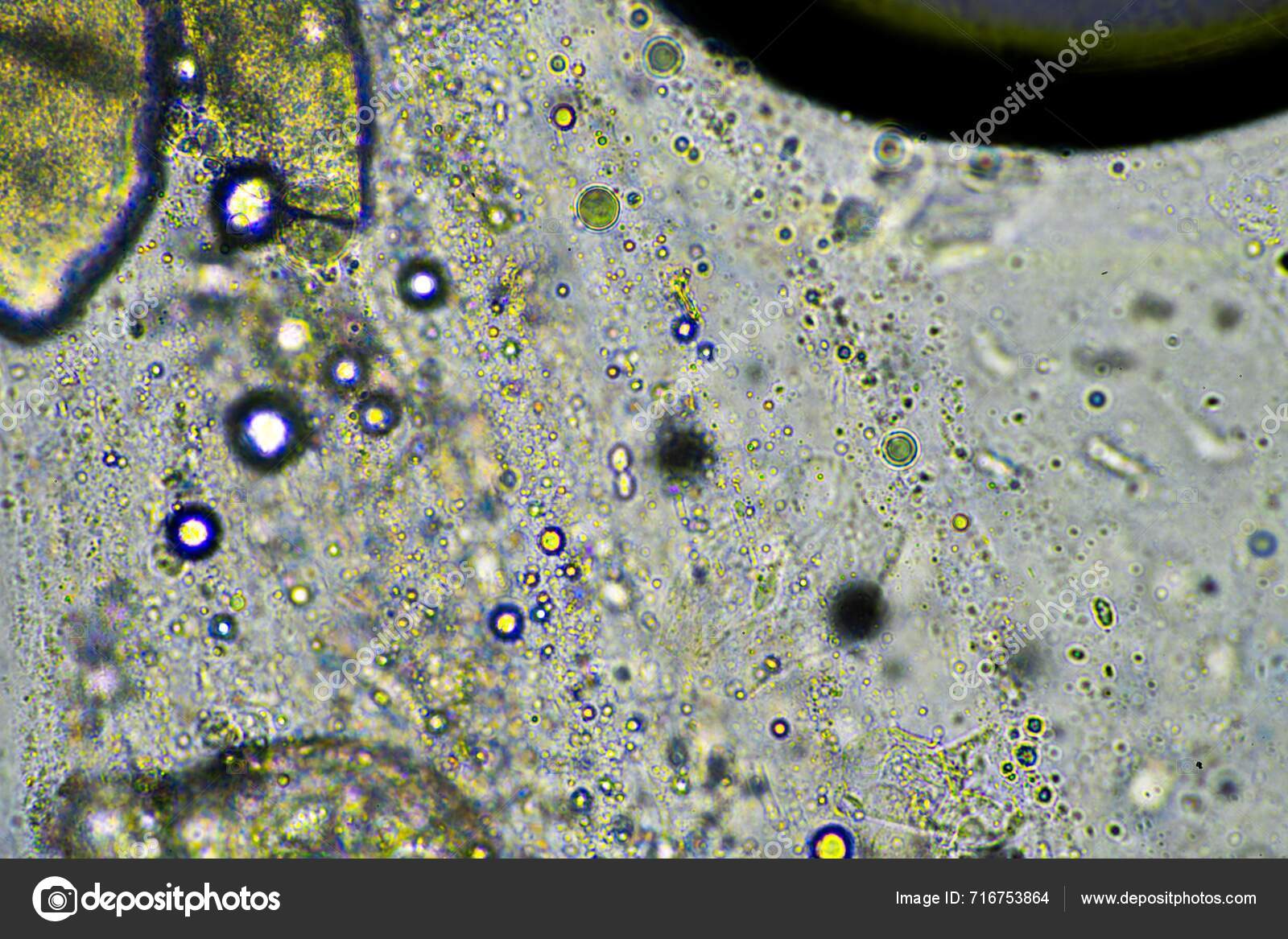 Green Mucus Coughing Phlegm Microscope Looking Influenza Cells Cold ...