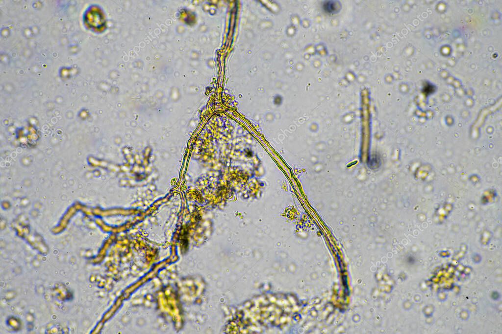 Microscopio De Zooflagelados Un Español Y El Apasionante Mundo