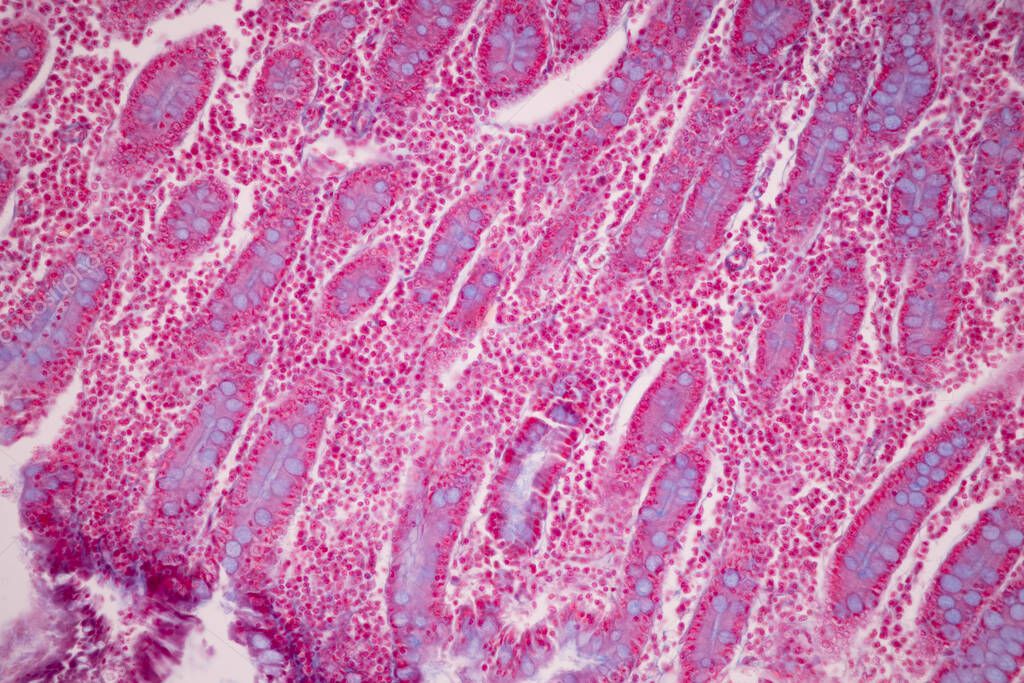 Tissue of Small intestine (Duodenum), Large intestine Human and Stomach ...