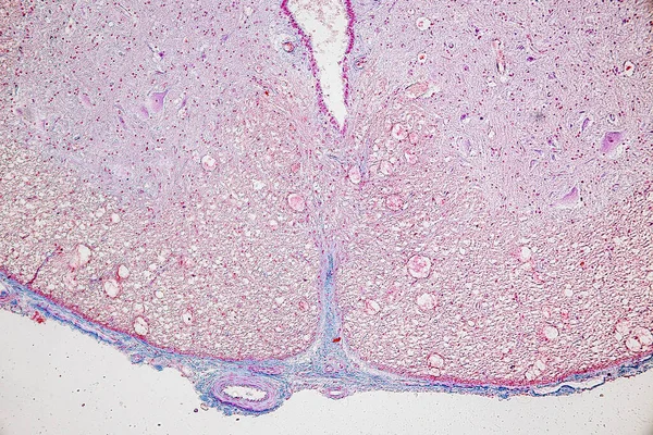 Neur n motor, m dula espinal, fibras nerviosas y c lulas nerviosas bajo ...