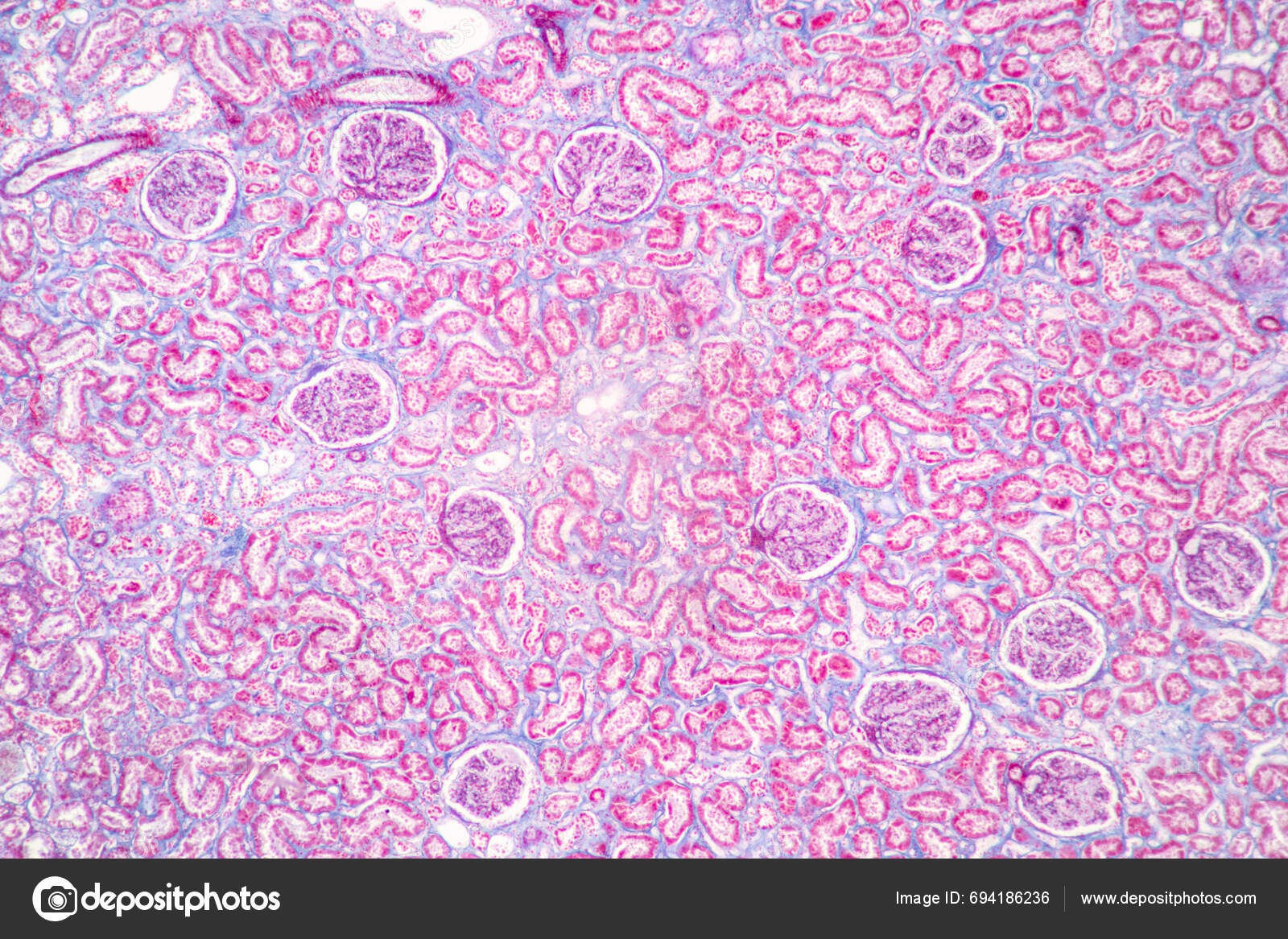 Structure Tissue Spleen Human Liver Human Kidney Human Microscope Lab ...