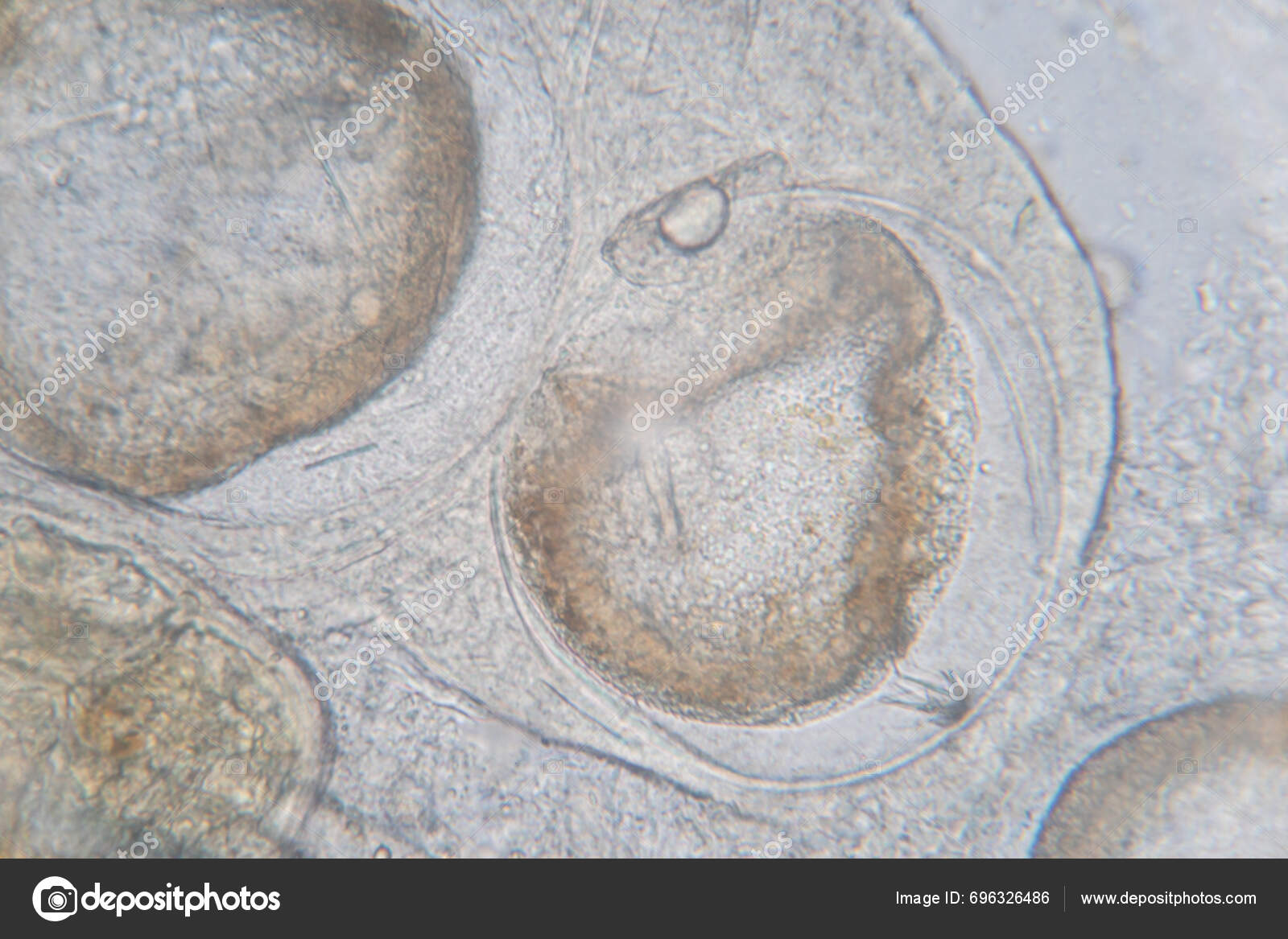 Study Parasitic Helminths Trematodes Marine Fishes Microscope — Stock ...