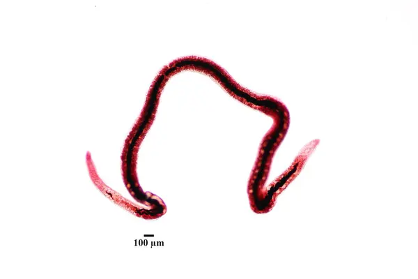 Estudio de helmintos parásitos (Trematodes) y Ascaris de peces bajo un ...