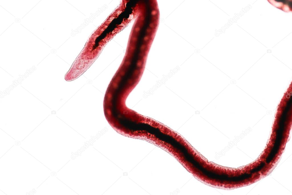 Estudio de helmintos parásitos (Trematodes) y Ascaris de peces bajo un ...