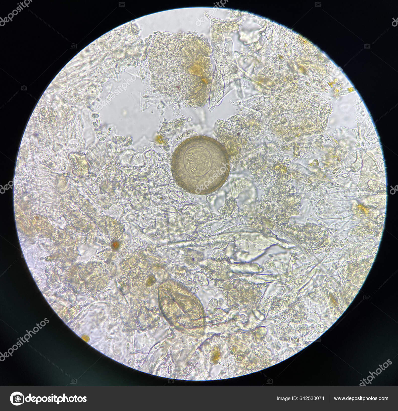 Hymenolepis Diminuta Huevo Parásito Humano Prueba Examen Heces ...