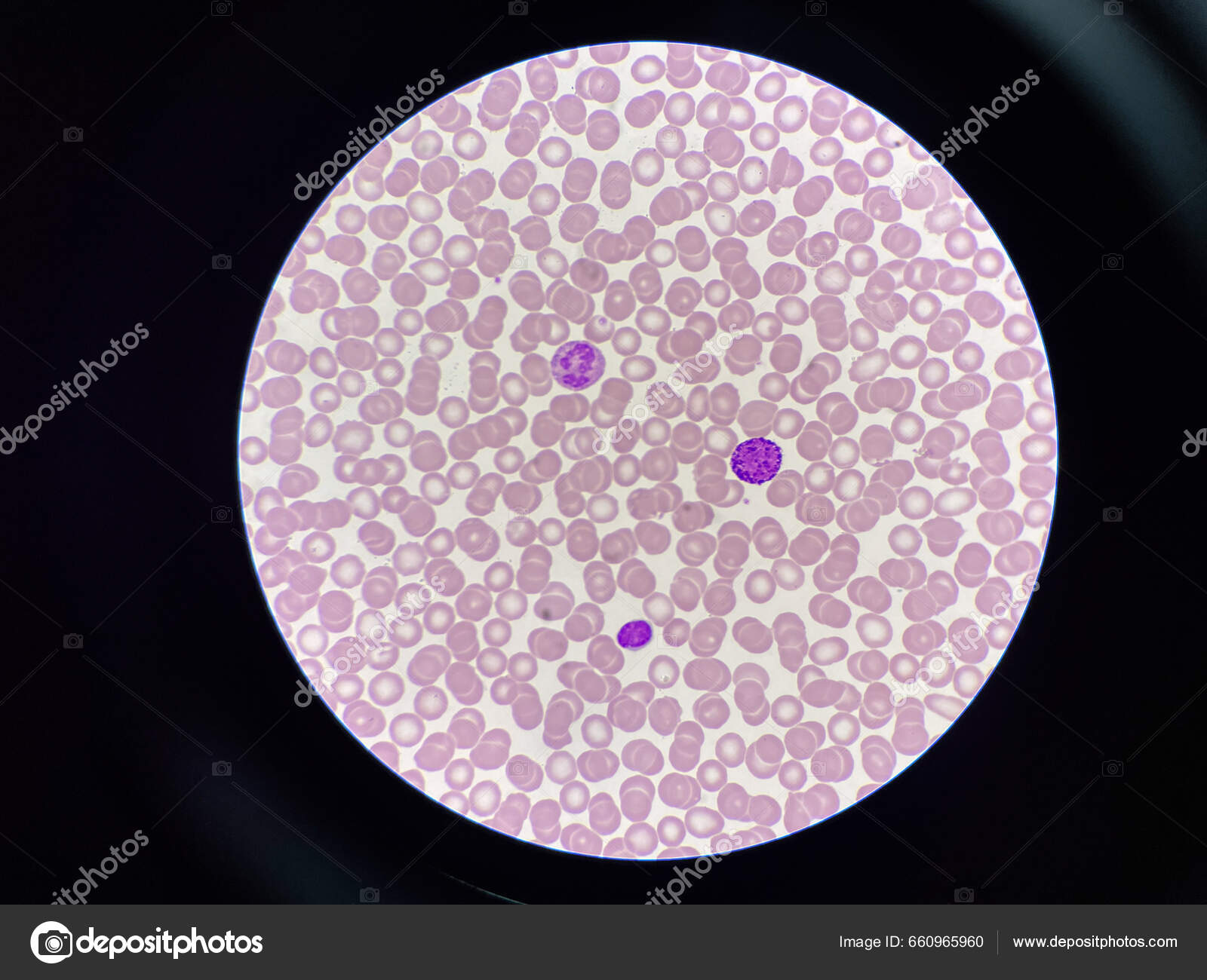 Linfocito Neutrófilos Basófilos Glóbulos Blancos Normales Con ...
