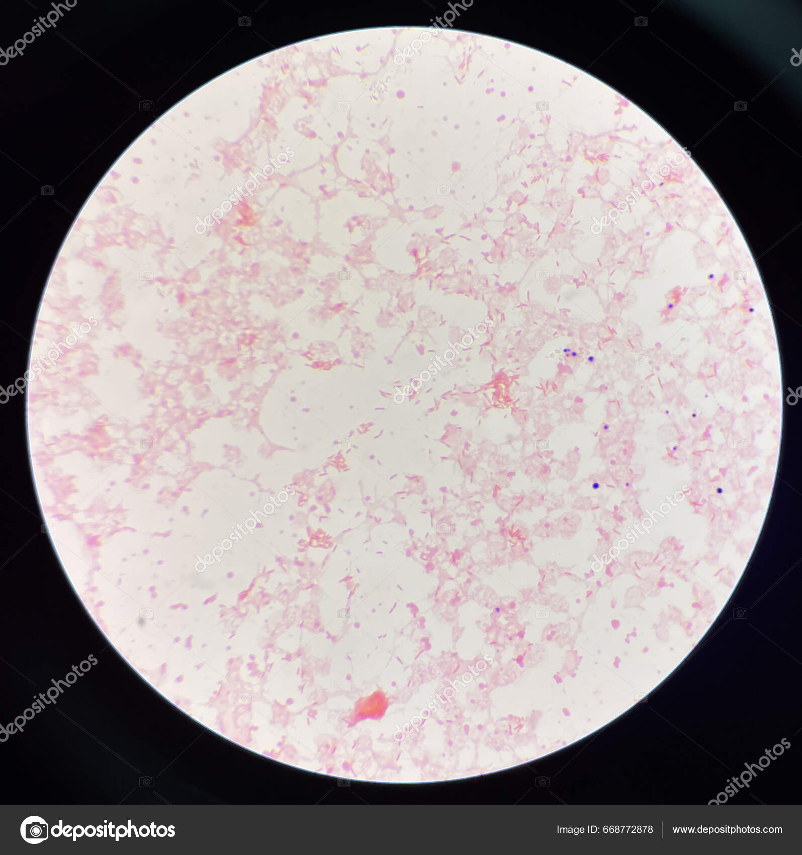 Gram Negative Bacteria Microscope