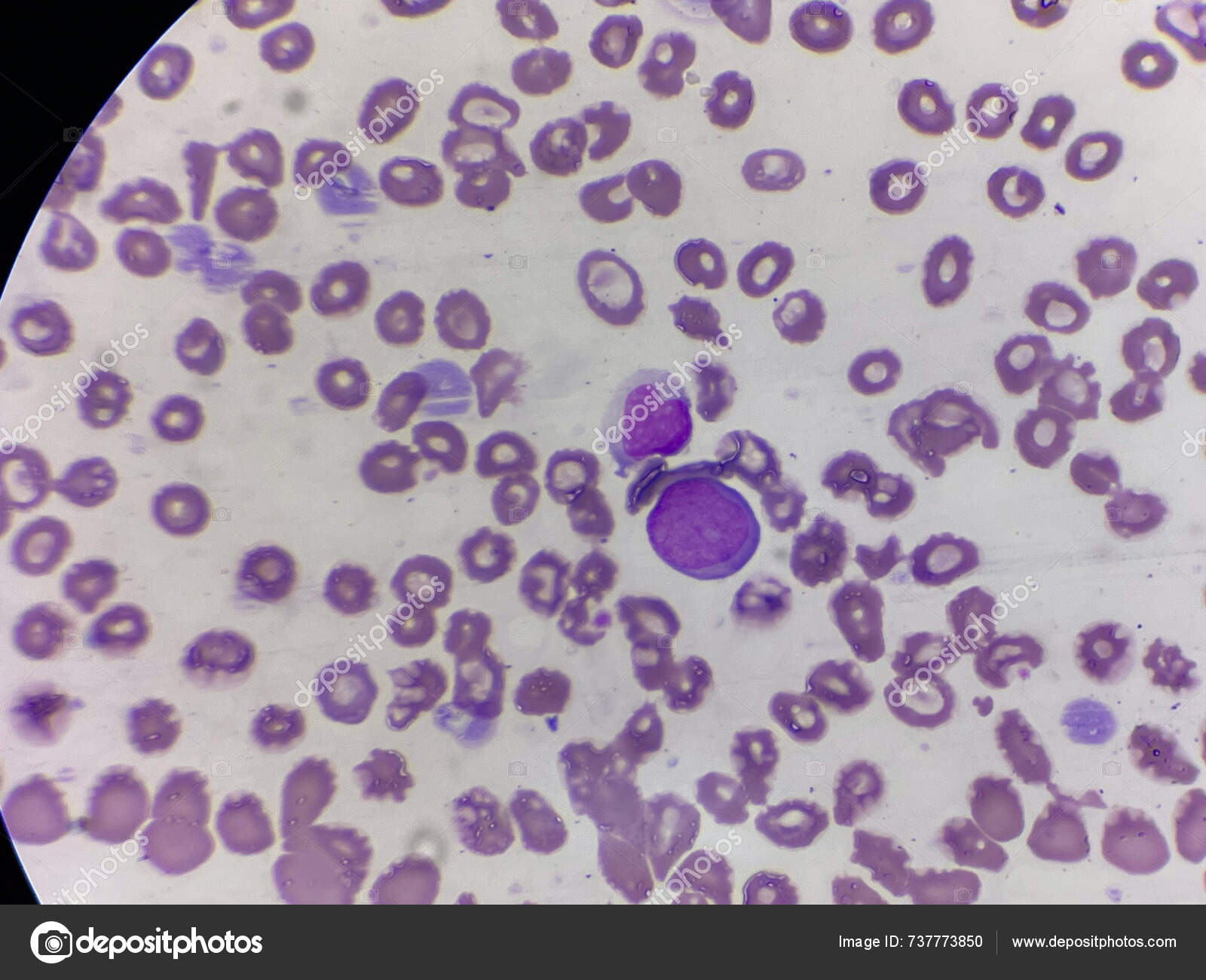 White Blood Cell Smear — Stock Photo © toeytoey #737773850