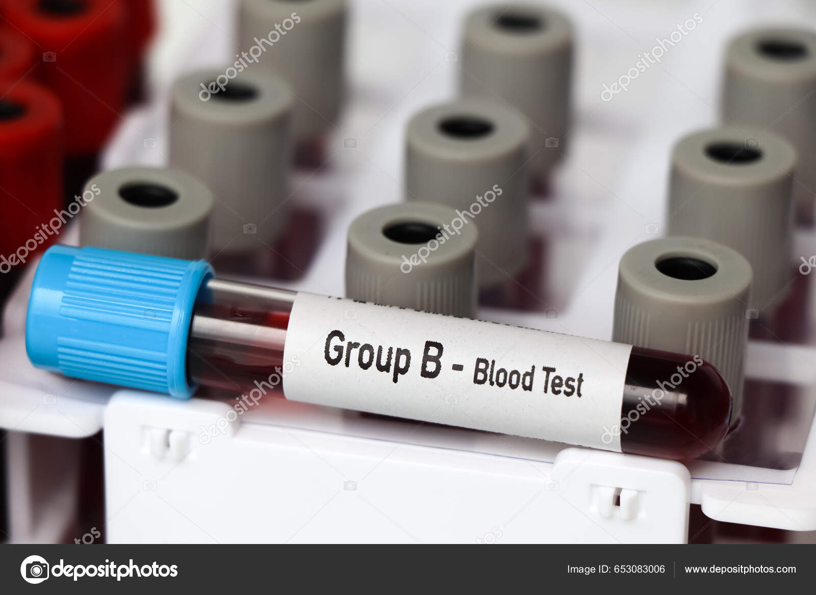 Group Blood Test Blood Sample Analyze Laboratory Blood Test Tube Stock ...