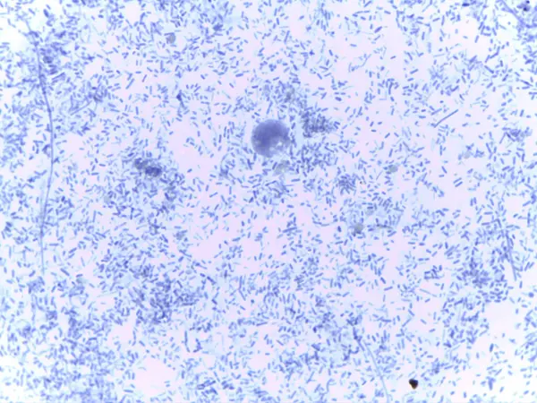 Mesophilic bacteria Stock Photos, Royalty Free Mesophilic bacteria ...