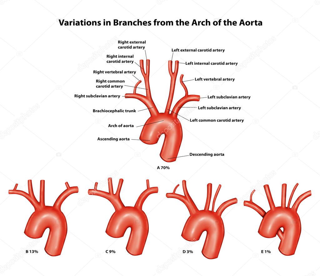 Variaciones en Ramas del Arco de la Aorta 2025