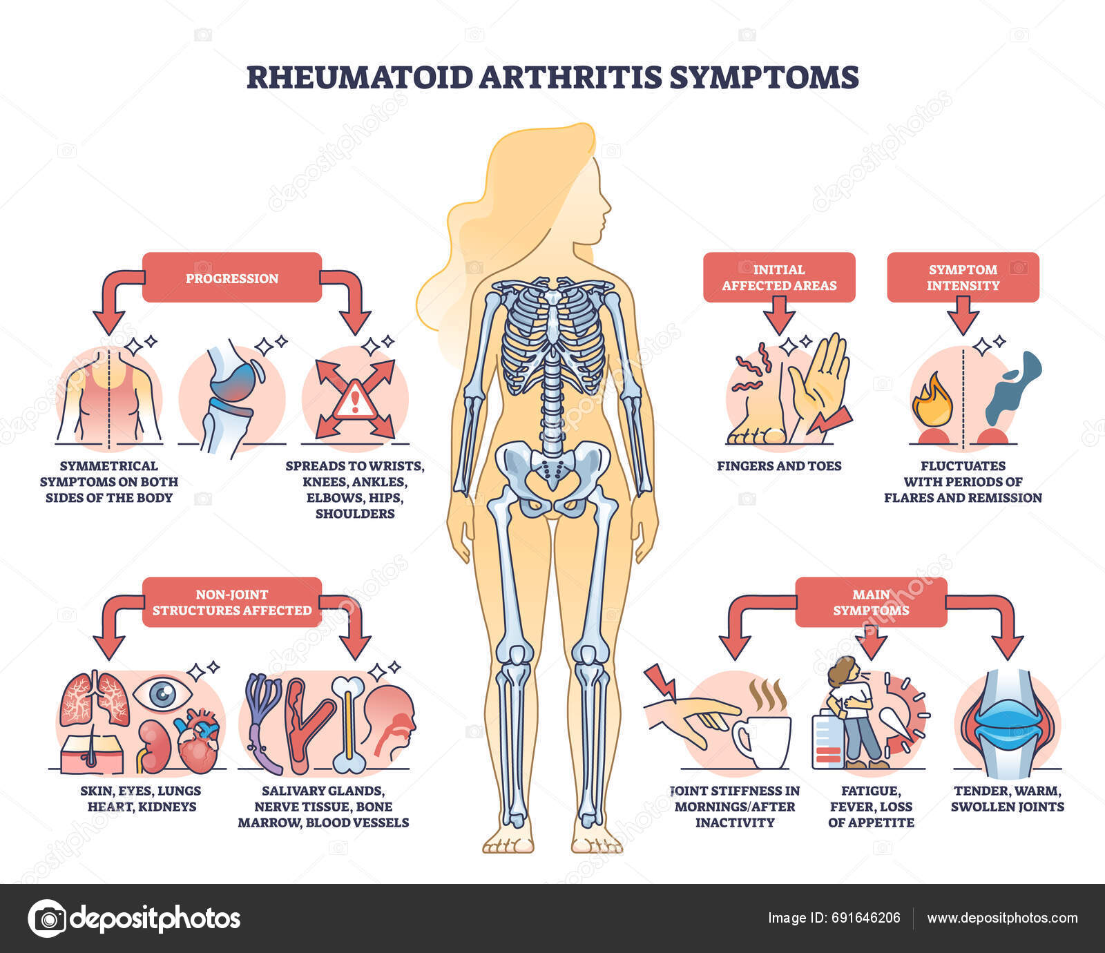 Revmatoid Artritt Symptomer Med Leddbetennelse Sykdom Disposisjon ...