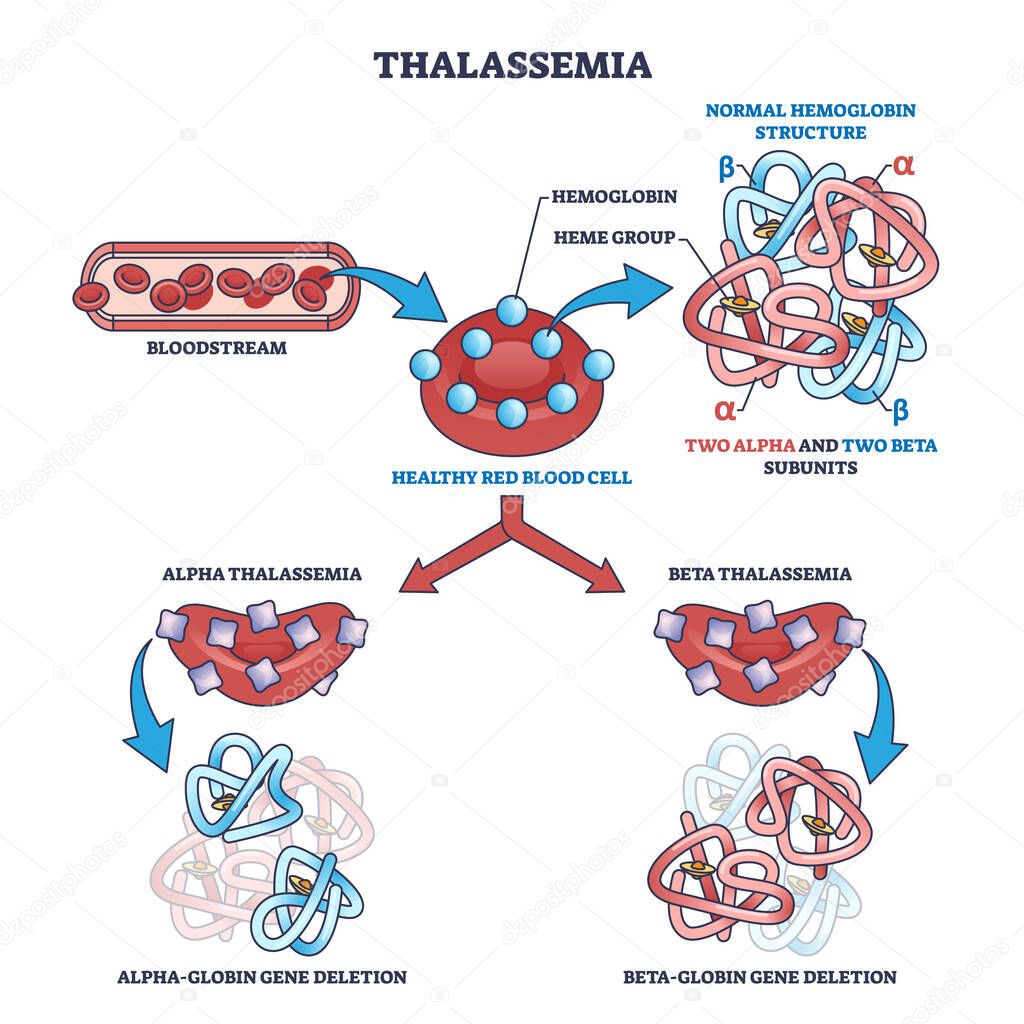 Talasemia enfermedad de la sangre como estructura de hemoglobina esquema de deleci n. Esquema ...