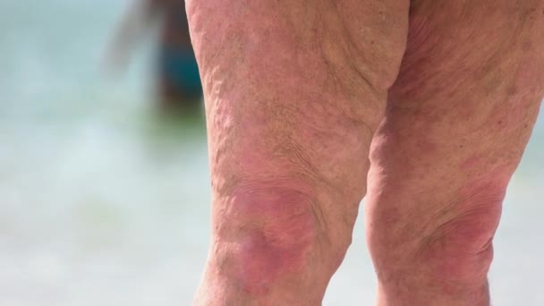 187 Fat grandpa Videos, Royalty-free Stock Fat grandpa Footage ...