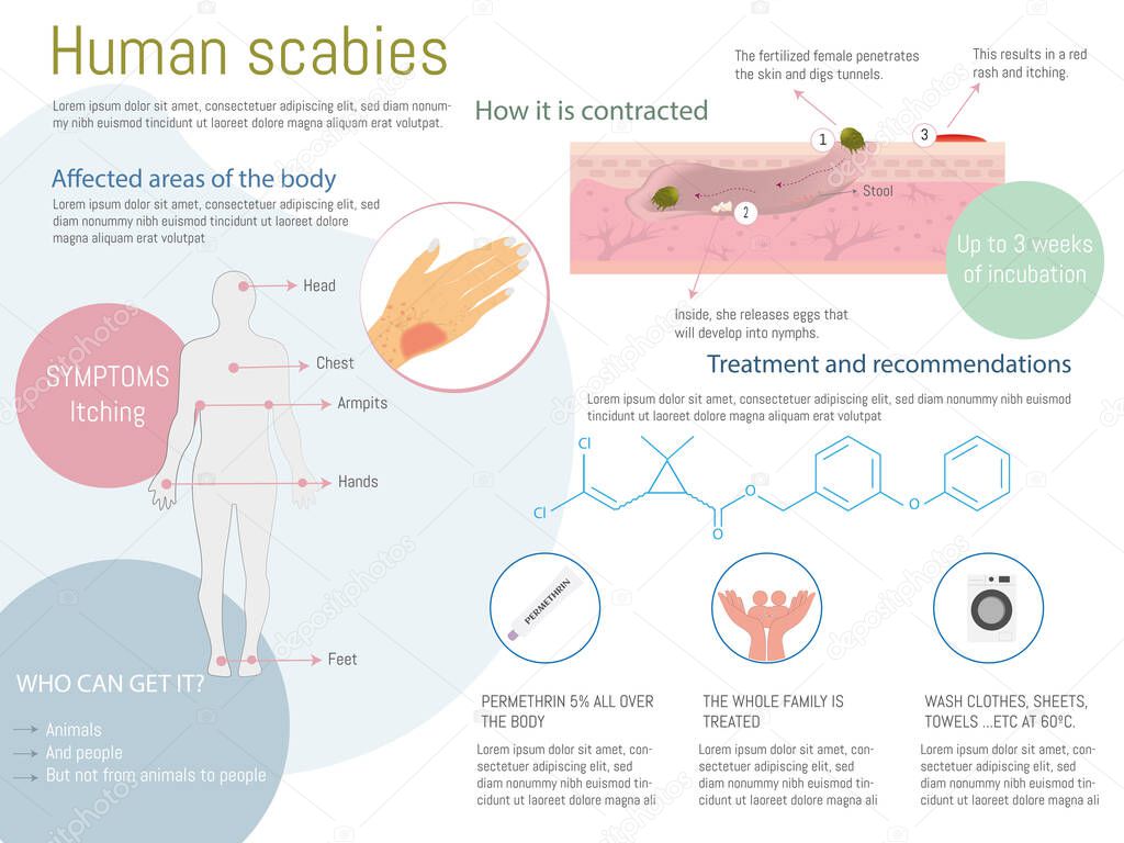 Sarna en la infografía humana. Cómo se propaga, el tratamiento, los ...