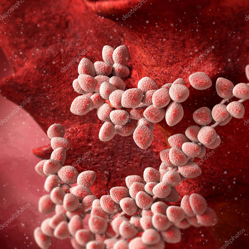 Medical background, Staphylococcus aureus, a type of spherical gram ...