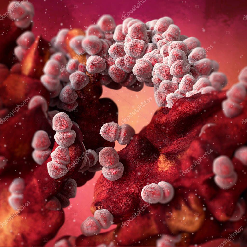 Medical background, Staphylococcus aureus, a type of spherical gram ...