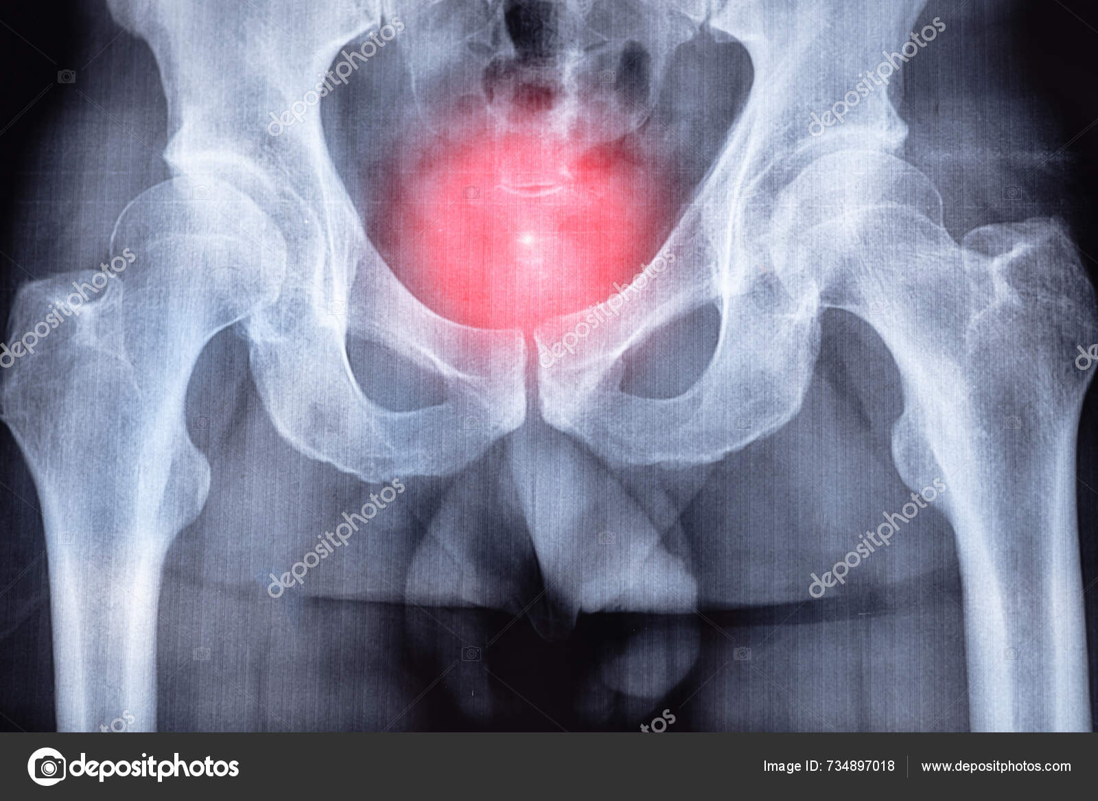 Ray Mri Mrt Human Spine Defects Bones Vertebrae Medical Treatmant ...