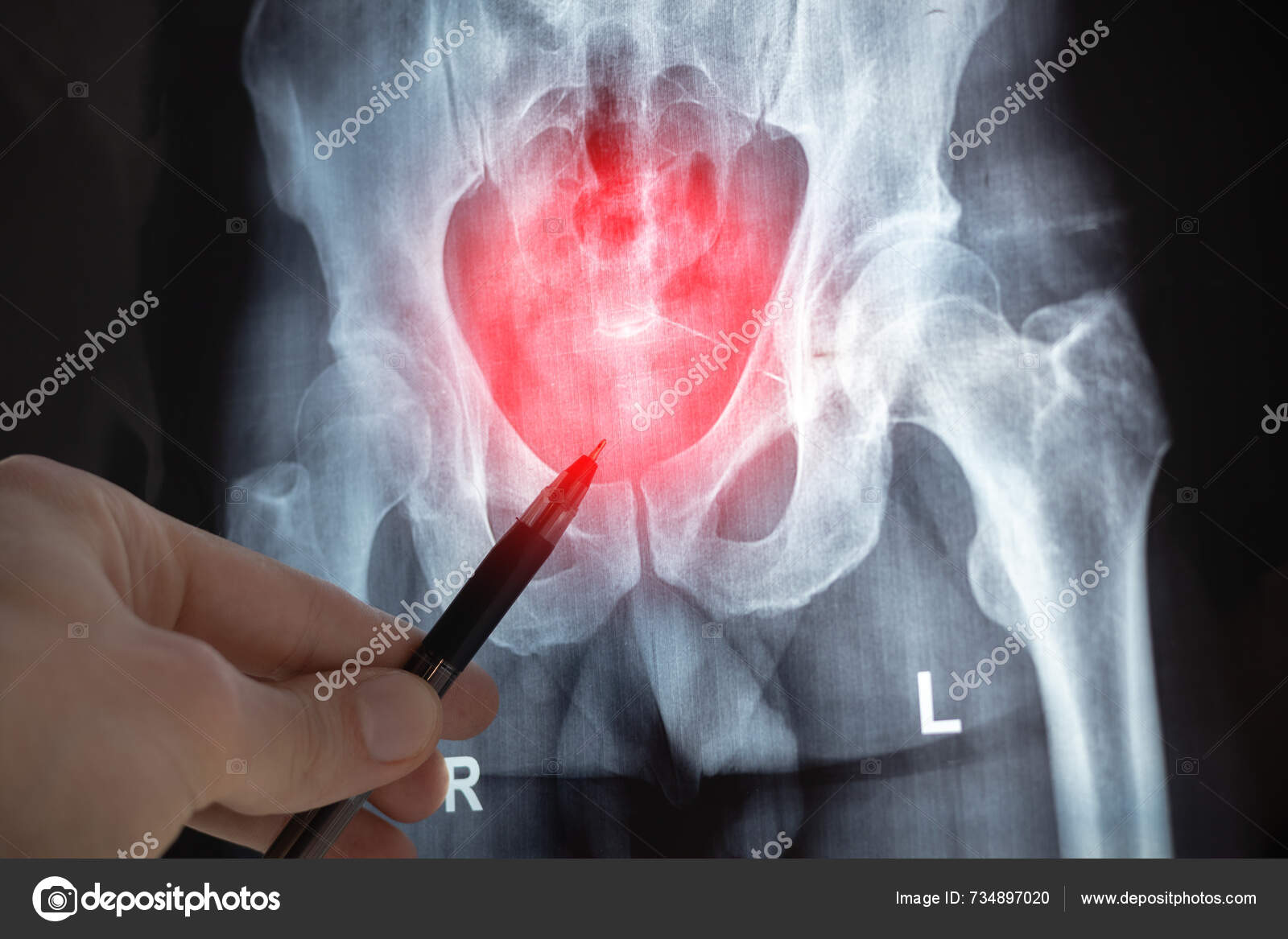 Doctor Examining Ray Mri Mrt Human Spine Defects Bones Vertebrae ...