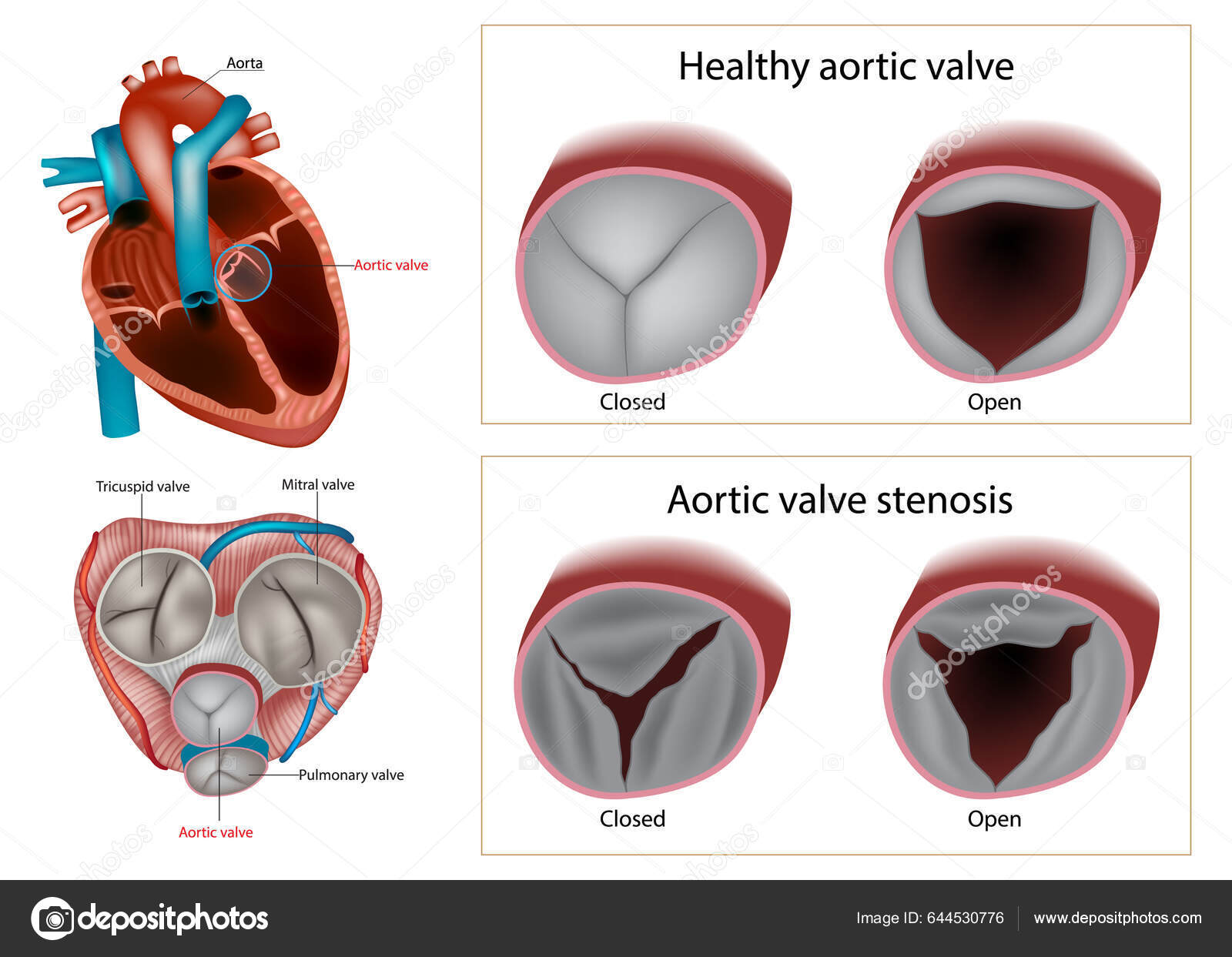Diagramma Della Valvola Cardiaca