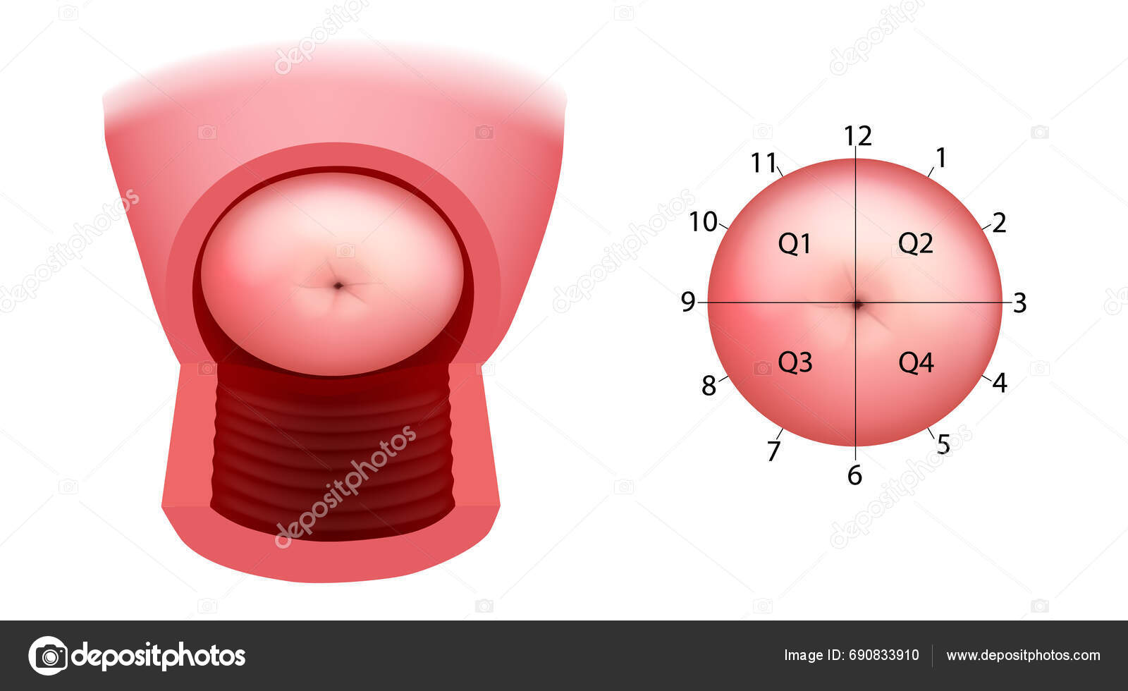 Cervix Quadrants Directions Anatomical Position Cervix Colposcopy Cervix Uteri Anatomy Stock