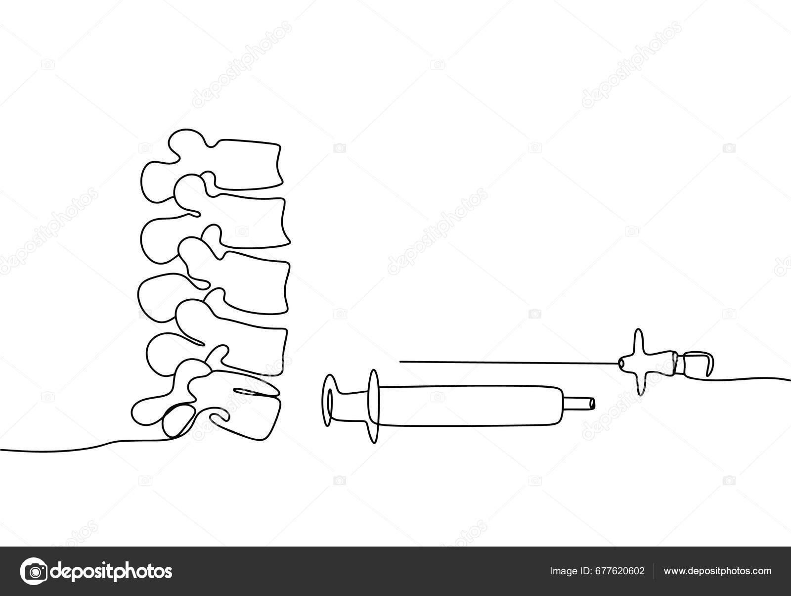 Lumbar Spine Syringe Epidural Anesthesia World Anaesthesia Day One Line ...