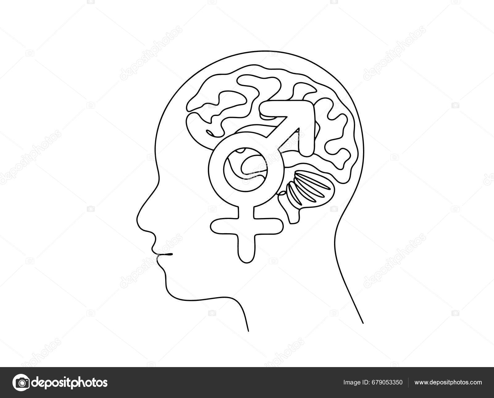 Brain Person Intersex Development Presence Male Female Sexual