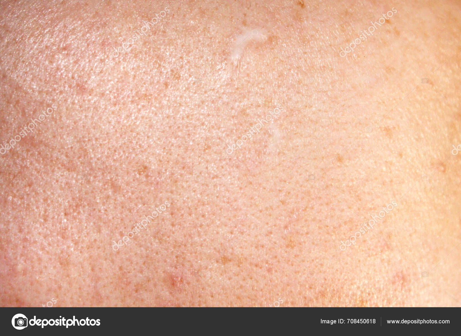 Skin Texture Scar Close Stock Photo Human Skin Best Quality — Stock ...