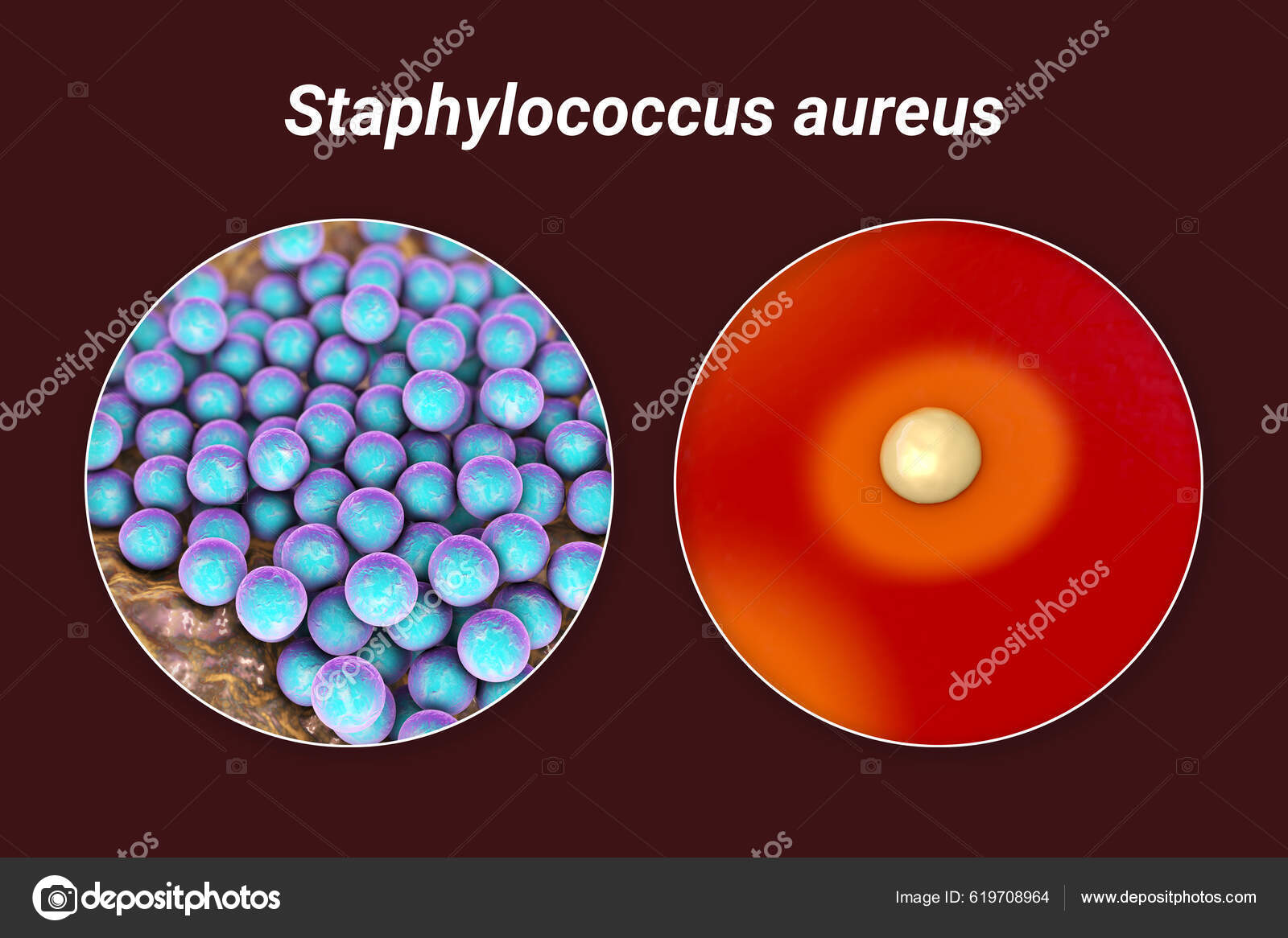 Bacteria Staphylococcus Aureus Colonies Sheep Blood Agar Medium Closeup ...