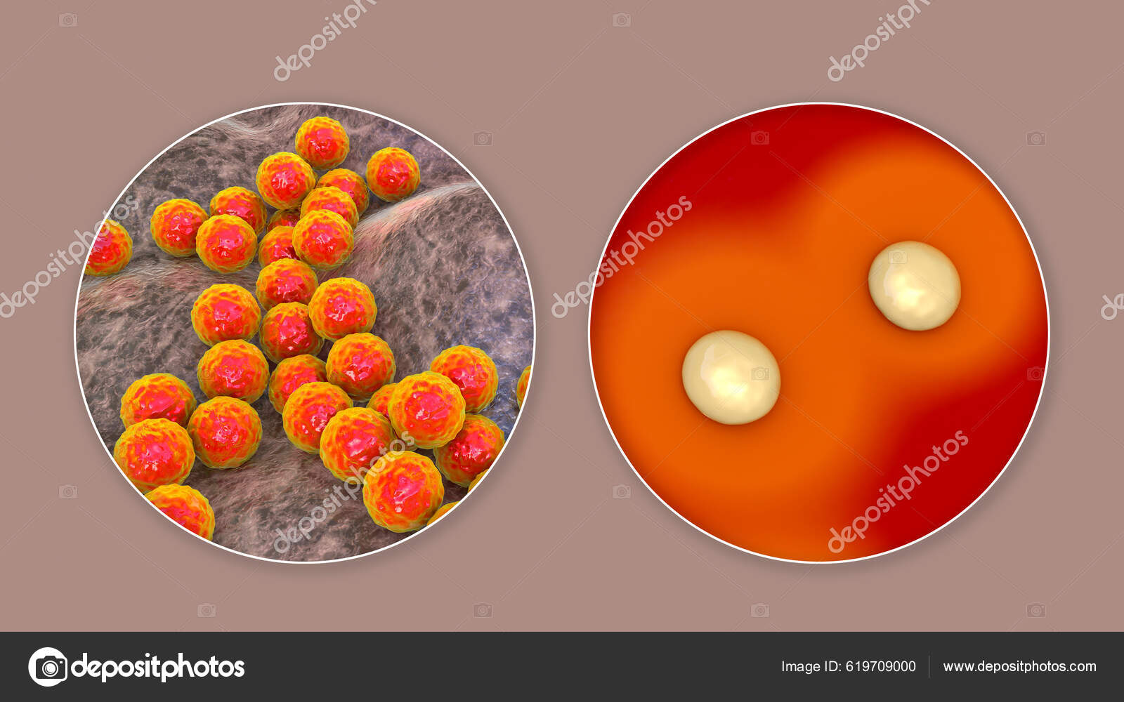 Bacteria Staphylococcus Aureus Colonies Sheep Blood Agar Medium Closeup ...