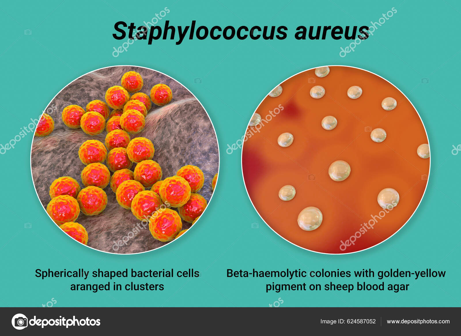 Bacteria Staphylococcus Aureus Colonies Sheep Blood Agar Medium Closeup ...