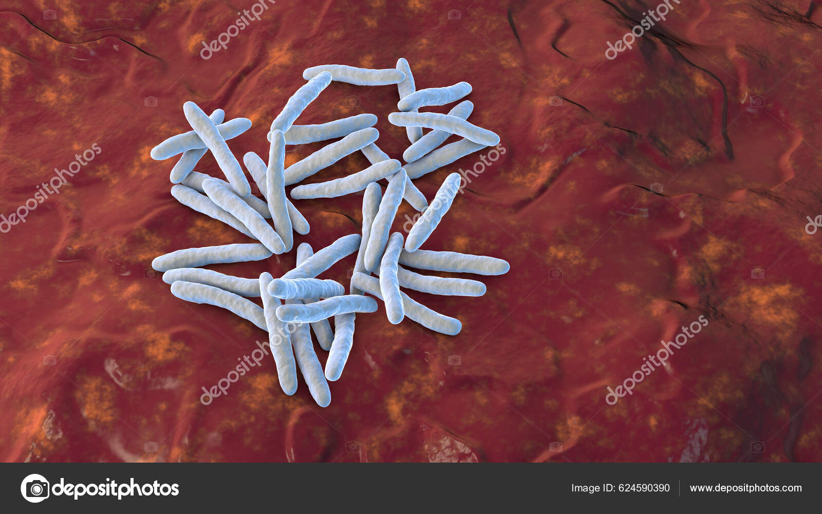 Bacteriile Mycobacterium Tuberculosis Agentul Cauzal Tuberculozei Ilustrație Pot Utilizate ...