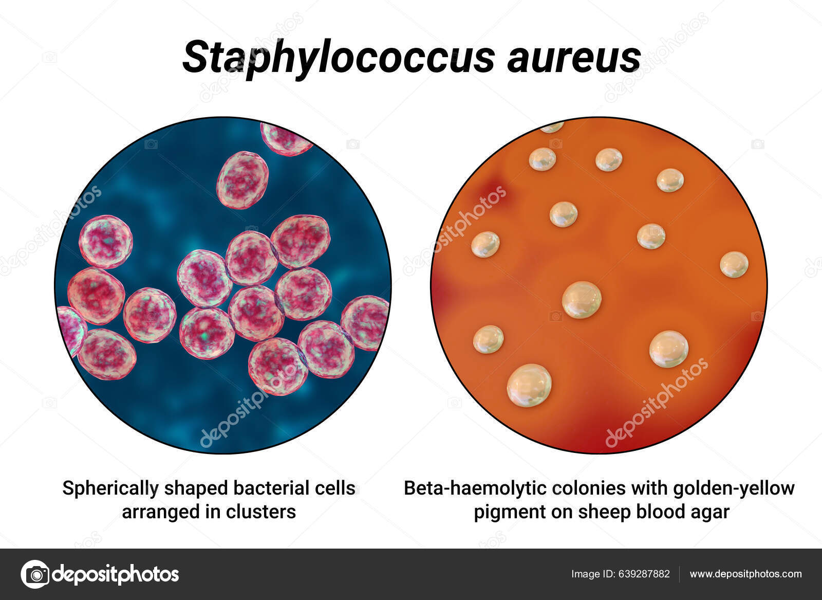 Bacteria Staphylococcus Aureus Colonies Sheep Blood Agar Medium Closeup ...