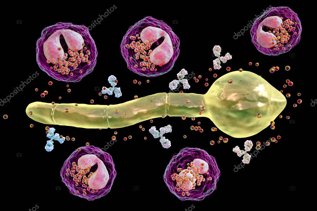 Splendore-Hoeppli phenomenon, 3D illustration. Eosinophilic reaction ...