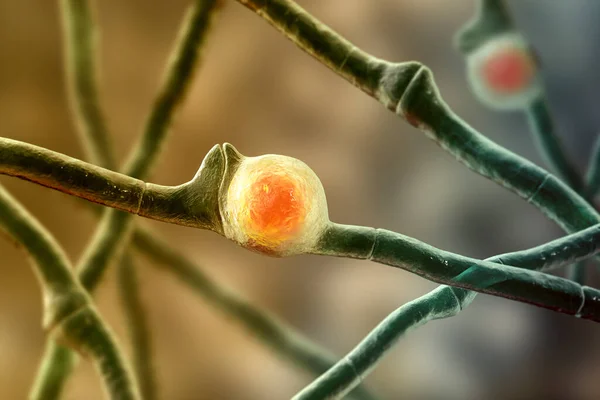 Basidiobolus ranarum hongos microscópicos, ilustración 3D. Causa ...