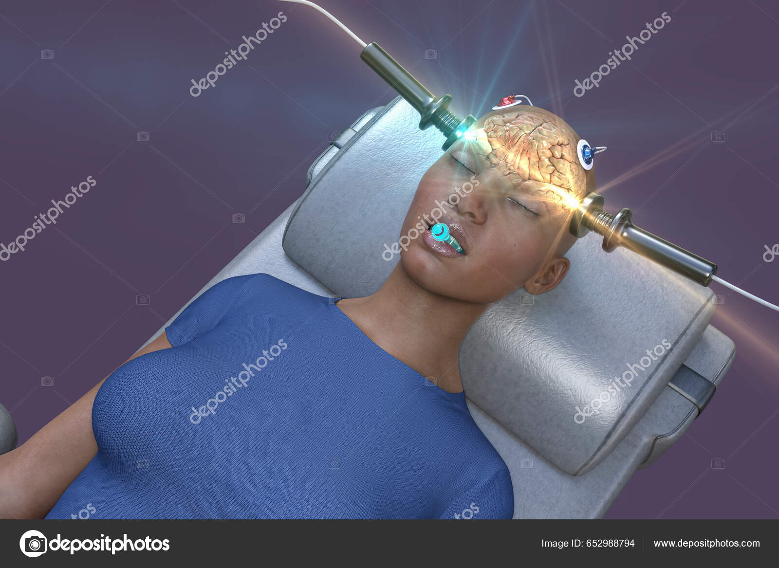 Electroconvulsive Therapy Ect Treatment Used Severe Mental Illnesses ...