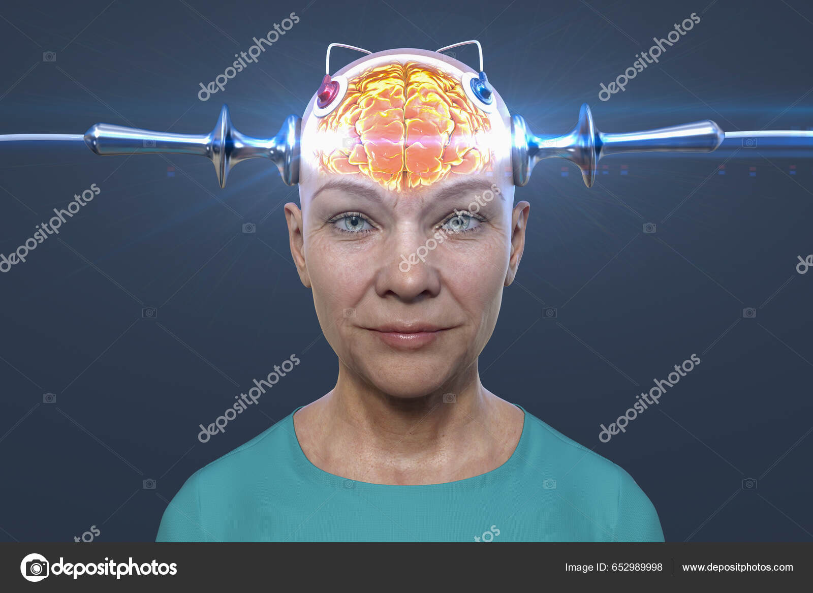 Electroconvulsive Therapy Ect Treatment Used Severe Mental Illnesses ...