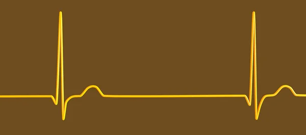 Detailed Illustration Electrocardiogram Ecg Displaying Sinus ...
