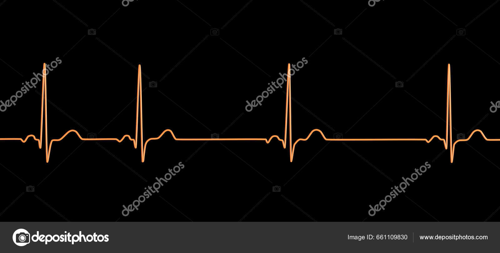 Detailed Illustration Electrocardiogram Ecg Displaying Sinus Arrhythmia ...