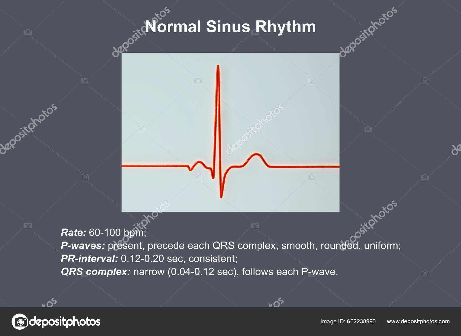 Electrocardiograma Ecg Normal Ilustración Que Muestra Actividad ...