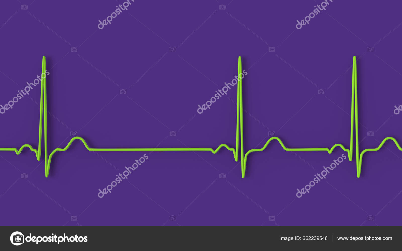 Una Ilustración Detallada Electrocardiograma Ecg Que Muestra Arritmia ...