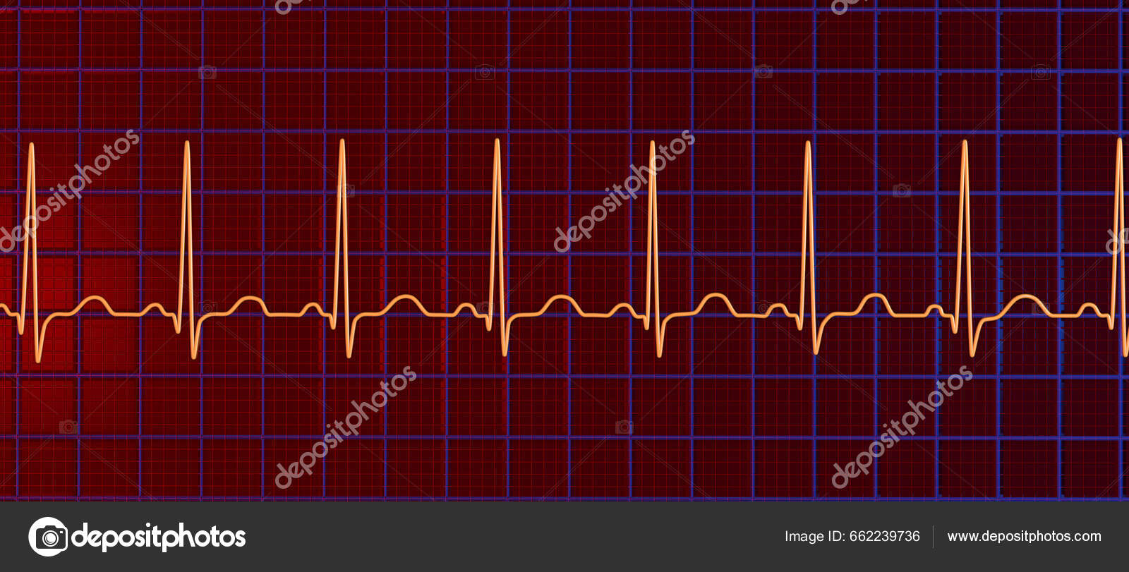 Una Ilustración Detallada Electrocardiograma Ecg Que Muestra ...