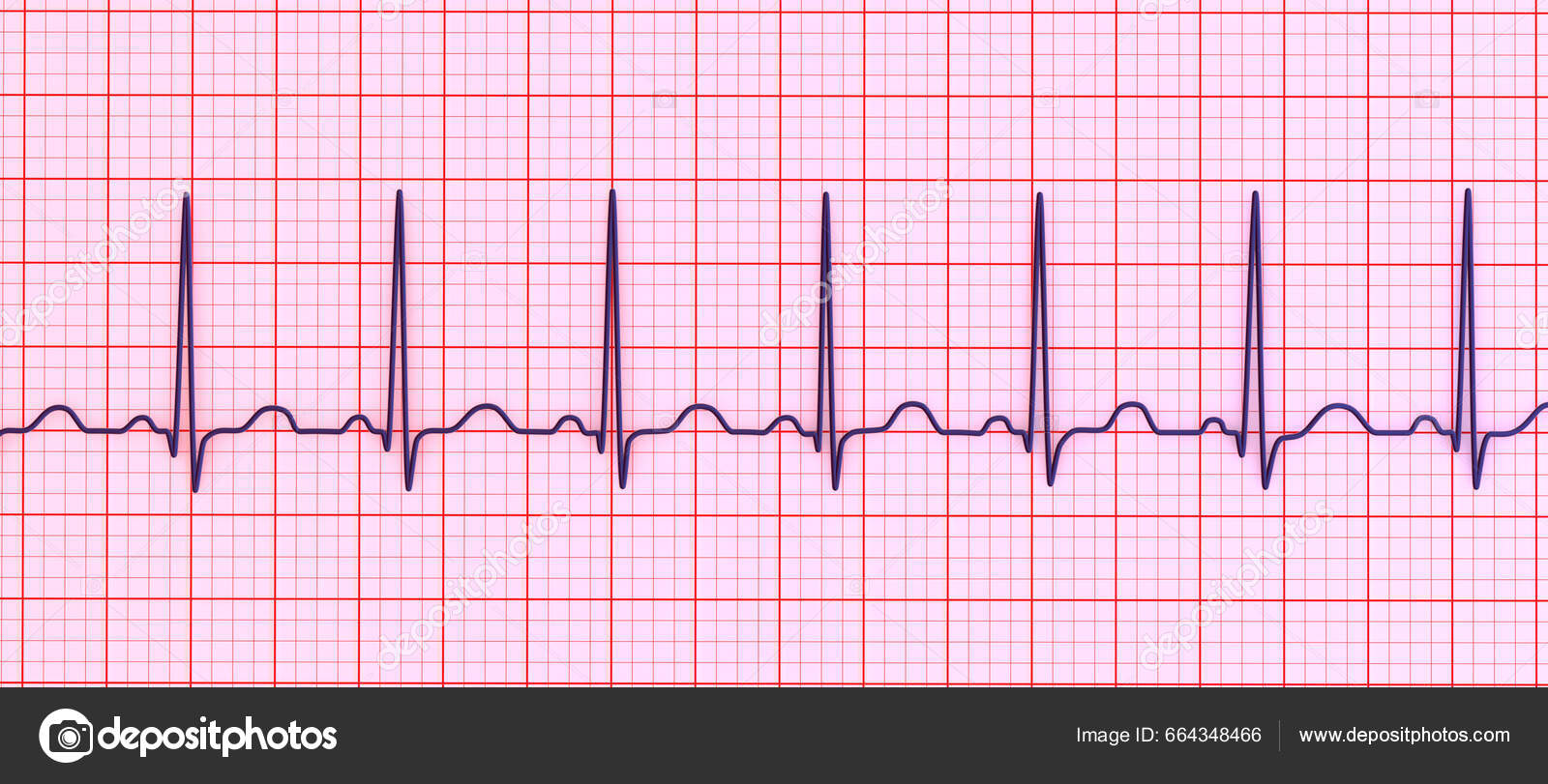 Detailed Illustration Electrocardiogram Ecg Displaying Sinus ...